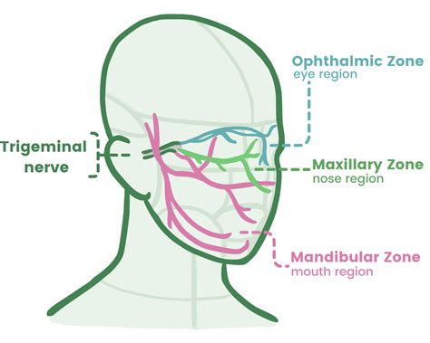 Cluster Headaches Vs Migraines How To Tell Them Apart