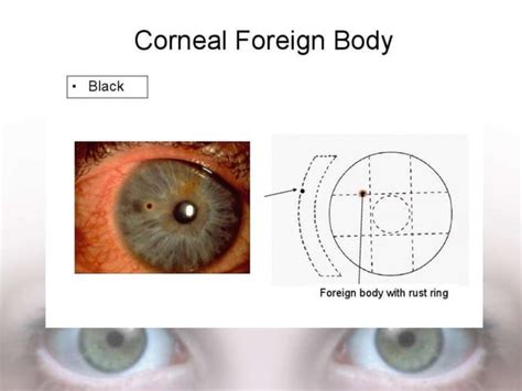 Eye Colour Coding
