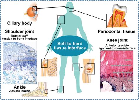 Fibrocartilage Examples Fractures Bone Bone Fractures