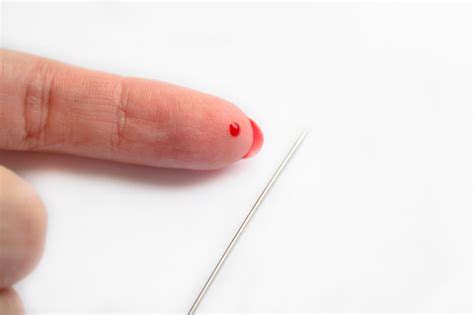 바늘로 뚫린 손가락에 피 한 방울 손가락의 혈액 분석 흰색 배경에는 피 한 방울과 바늘이있는 손가락이 옆에 있습니다 간호사에 대한 스톡 사진 및 기타 이미지 Istock