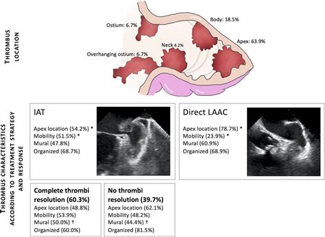 Management And Outcomes Of Patients With Left Atrial Appendage Thrombus Prior To Percutaneous