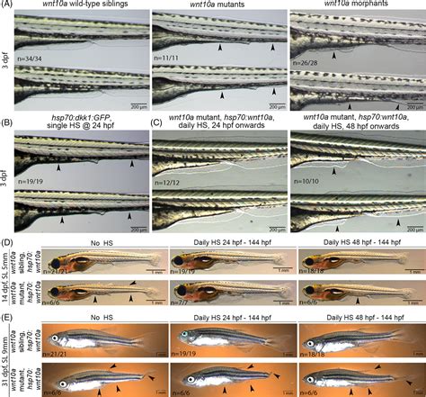 Wnt10a Is Required For Zebrafish Median Fin Fold Maintenance And Adult