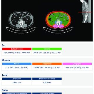 Case Example Of The Automatic Segmentation Performed By The Software At Download Scientific