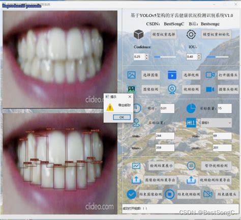 基于深度学习的高精度牙齿健康检测识别系统（pytorchpyside6yolov5模型）牙齿目标检测 Csdn博客
