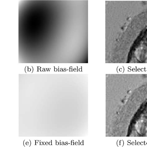 Illumination In Homogeneity Correction By Removing The Bias Field Download Scientific Diagram