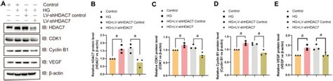 Down Regulation Of Histone Deacetylase 7 Reduces Biological Activities Of Retinal Microvascular