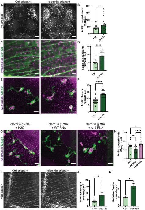 Quantification Of Autophagy And Mitophagy In Clec16a Crispants A Download Scientific Diagram