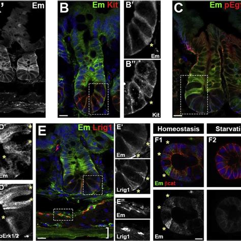 Distinct Patterns Of Egfr Em Expression In Small Intestine A Egfr Em