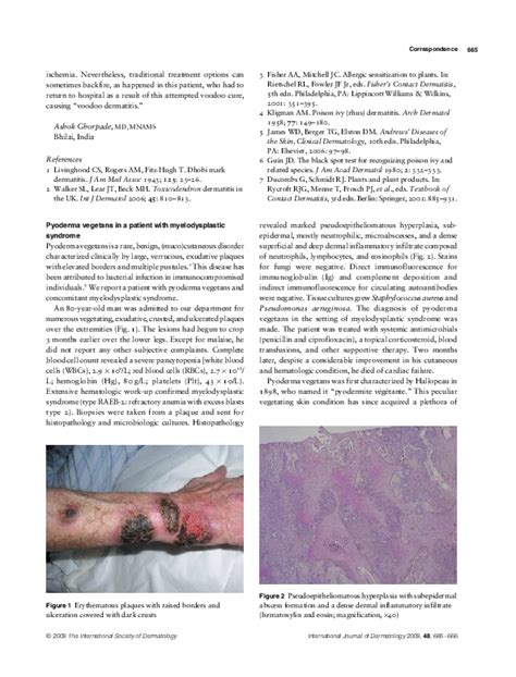 Pdf Pyoderma Vegetans In A Patient With Myelodysplastic Syndrome