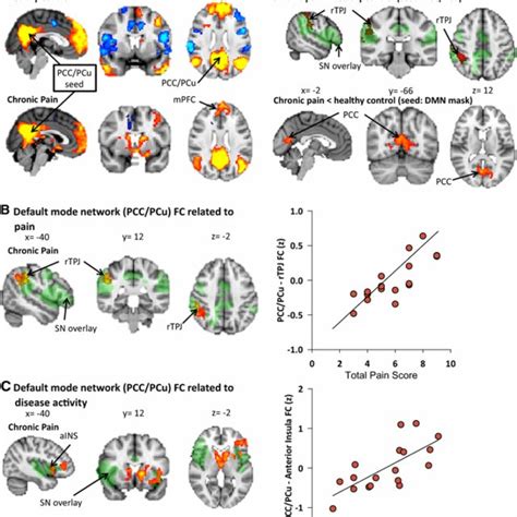 Primary Motor Cortex M1 Connectivity A The Location Of The M1 Seed