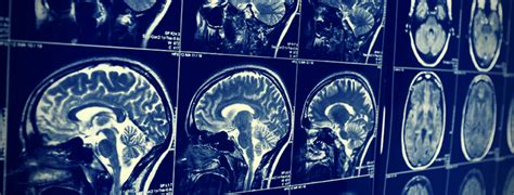 Deep Learning Applications In Medical Imaging Emerj Artificial Intelligence Research