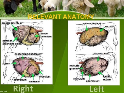 An Introduction To Exploratory Laparotomy What Is An