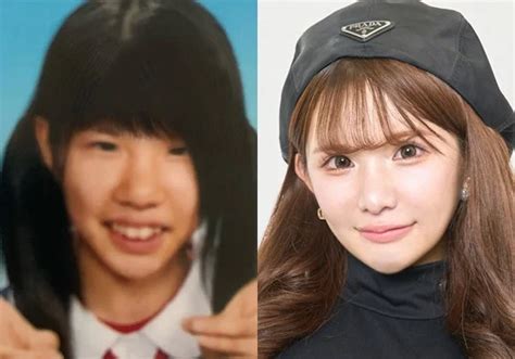 Japanese Influencer Claims 140000 Worth Of Plastic Surgery Completely