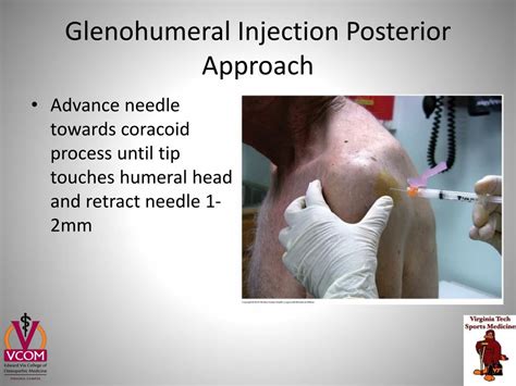 Ppt Shoulder Girdle Joint Injection Workshop Powerpoint Presentation Id 6989874