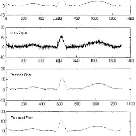Ecg Signal Before And After Filtration Download Scientific Diagram