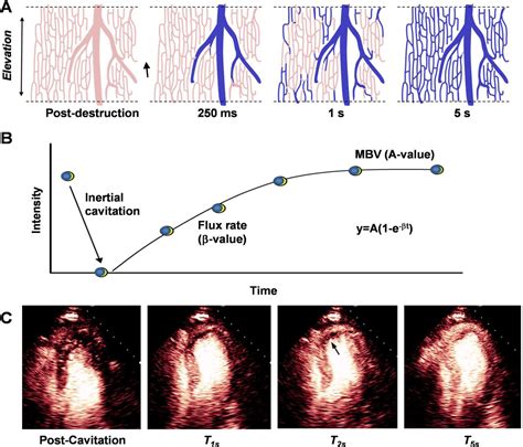 Contrast Echocardiography Current Status And Future Directions Heart