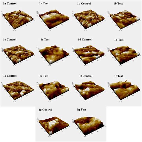 The Effects Of Different Surface Preparation Techniques On Enamel Surface Properties And Bond