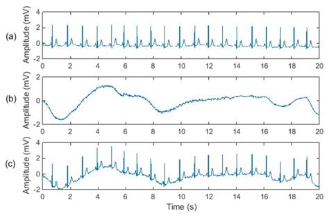 Comparison Of Motion Artefact Reduction Methods And The Implementation Of Adaptive Motion