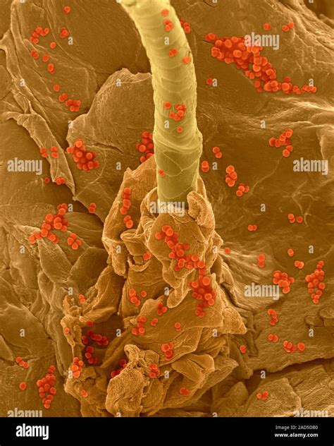Coloured Scanning Electron Micrograph Sem Of Photocomposite