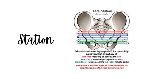 Fetal Station Fetal Pelvis Station