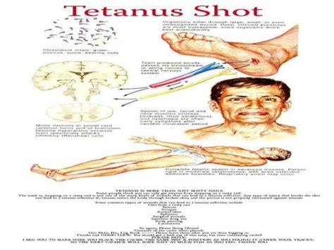 Tetanus