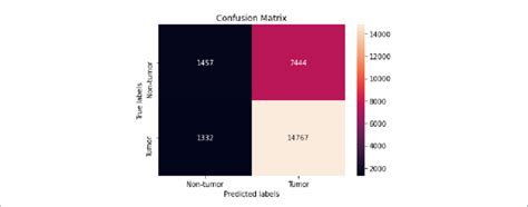 confusion matrix of the lightgbm model using sbert representations