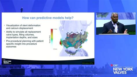 Next Generation Decision Support With Ai Based Predictive Modeling For Improved Long Term Next Generation Decision Support With Ai Based Predictive Modeling For Improved Long Term