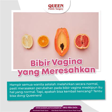 Labiaplasty Klinik Bedah Plastik Queen