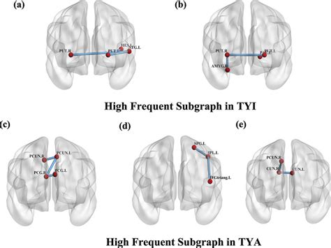 The Different Connectivity Patterns In The Mined Frequent Sub Networks