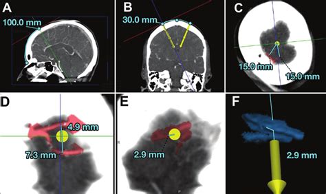 Three Dimensional Reconstructions Performed Using Medical Diagnostic