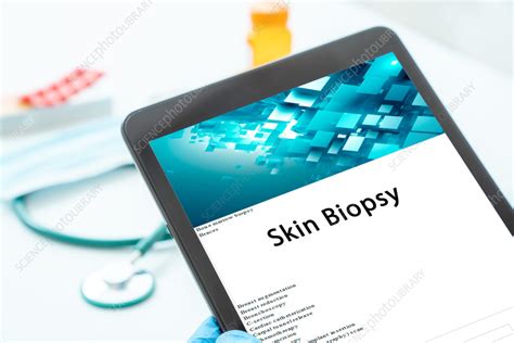 Skin Biopsy Stock Image F042 0273 Science Photo Library