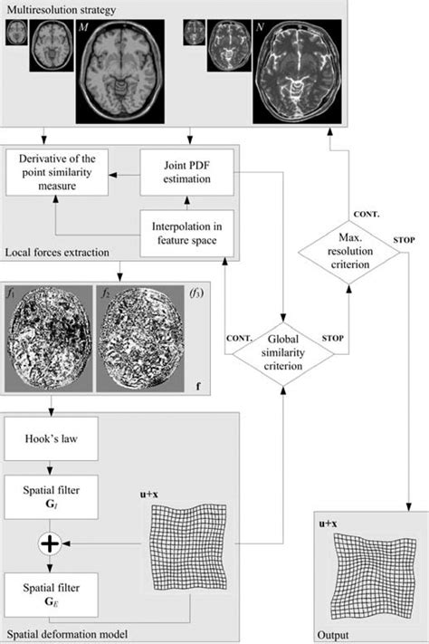 The Scheme Of The Deformable Registration Algorithm The Displacement