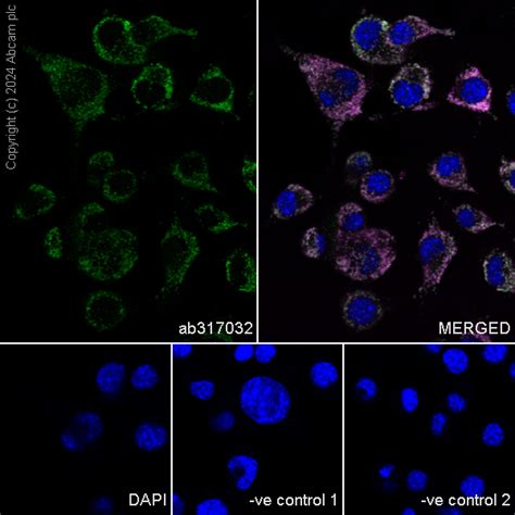 Anti Glutaminase Antibody [epr28716 72] Ab317032 Abcam