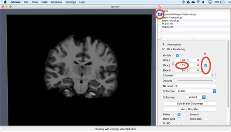 Freesurfer Tutorial Quantitative Imaging Toolkit