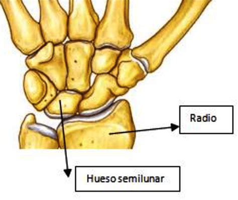 Opiniones De Hueso Semilunar Lbylyh Huesos De La Mano Modelo