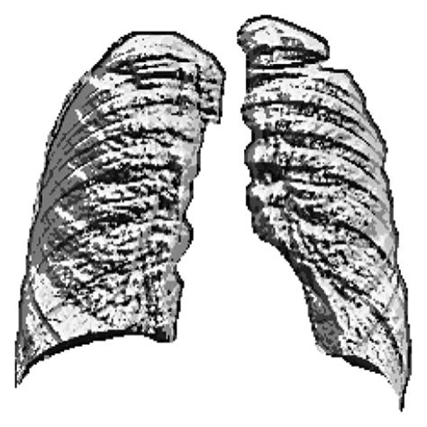 Generated Lbp Pattern Of X Ray For Various Weights A W 1 B W 2 Download Scientific