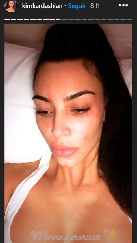 Kim Kardashian Posó Sin Maquillaje Para Mostrar Los Efectos De La