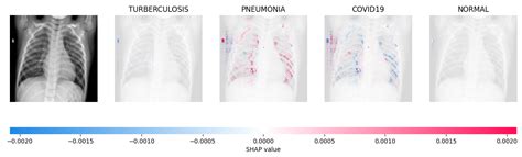 Evaluating Retinal Disease Diagnosis With An Interpretable Lightweight