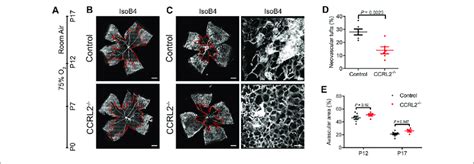 Ccrl2 Loss Of Function Protects Against Aberrant Neovascularization Download Scientific