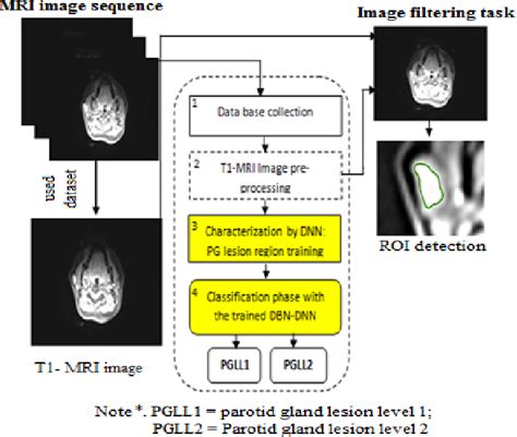 Figure 2 From Improving Parotid Gland Tumor Segmentation And Classification Using Geometric