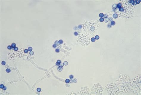 The Candida Puzzle Womens Wellness