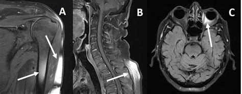 Examples Of Non Motion Induced Artifacts In Fetal Functional Mri The