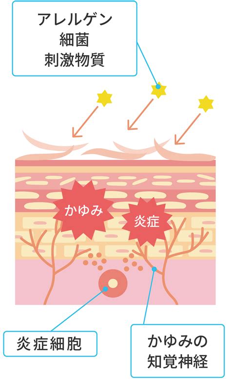 アトピー性皮膚炎という病気｜大人のアトピー性皮膚炎｜アトピース｜大塚製薬株式会社