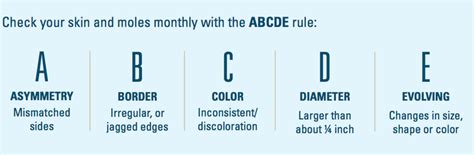 Is That Mole A Cause For Concern Heres How To Tell Phillyvoice