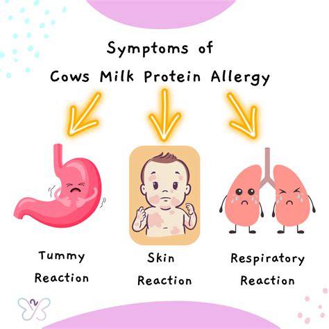 Allergic To Milk Milk Allergy Symptoms Causes Treatment And More