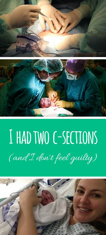 15 Can I Request An Elective C Section Information Build A