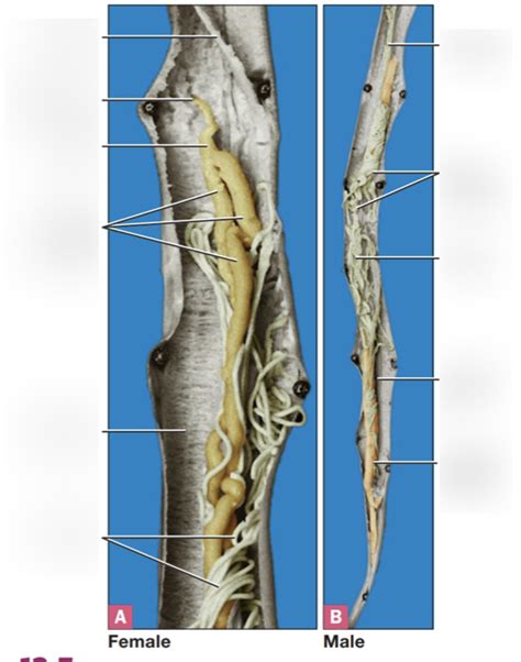 Roundworm Internal Diagram Quizlet