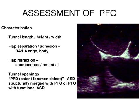 Ppt “pfo Closure Anatomical Variants And Implications For Choice Of