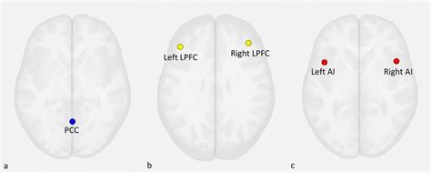 Seed Locations For Core Resting State Networks A Default Mode Network