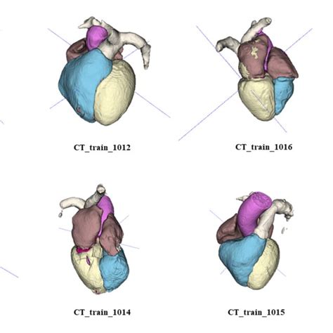 segmentation results for 8 ct volumes from mm whs dataset top 4 ct